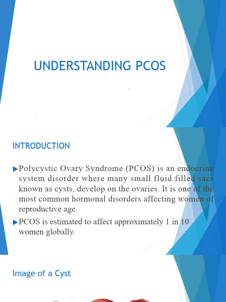 UNDERSTANDING PCOS(1) | PDF | Polycystic Ovary Syndrome | Human ...