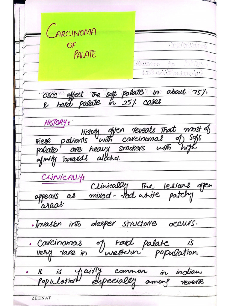 Carcinoma of Palate - Zaid | PDF