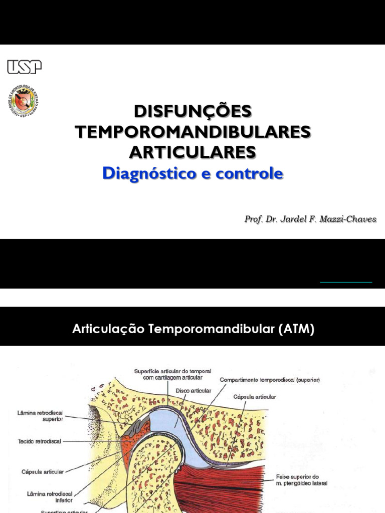 Aula DTM Articular Forp 2023 | PDF | Osteoartrite | Imagem de ...