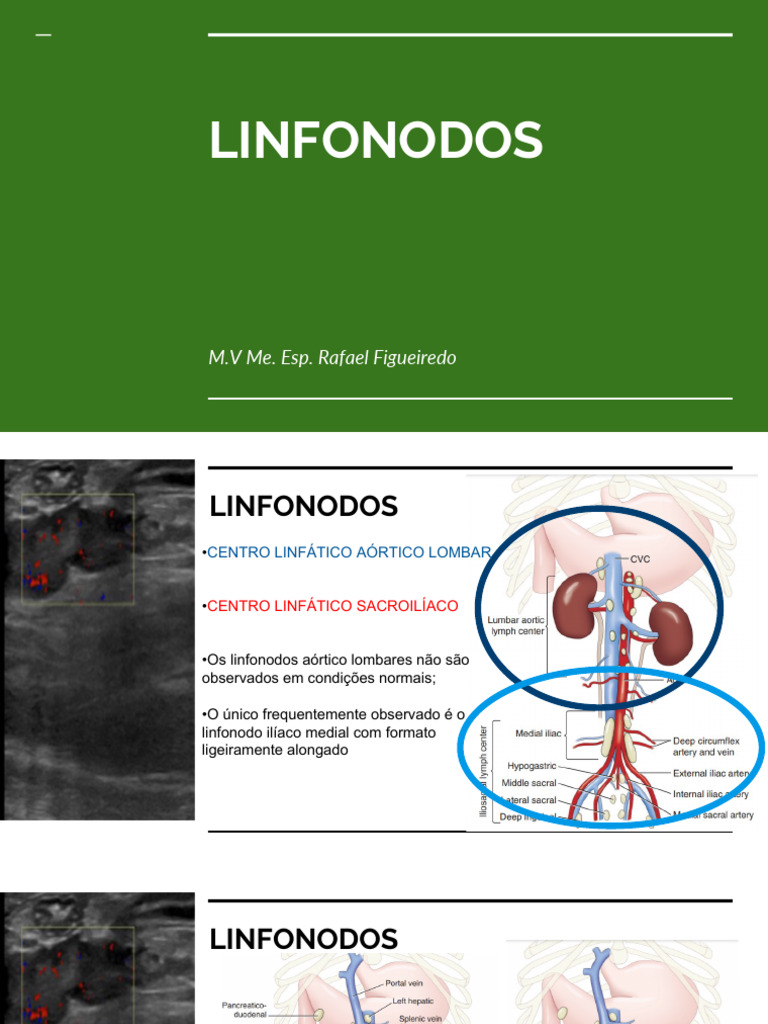 Aula 08 - LINFONODOS | PDF