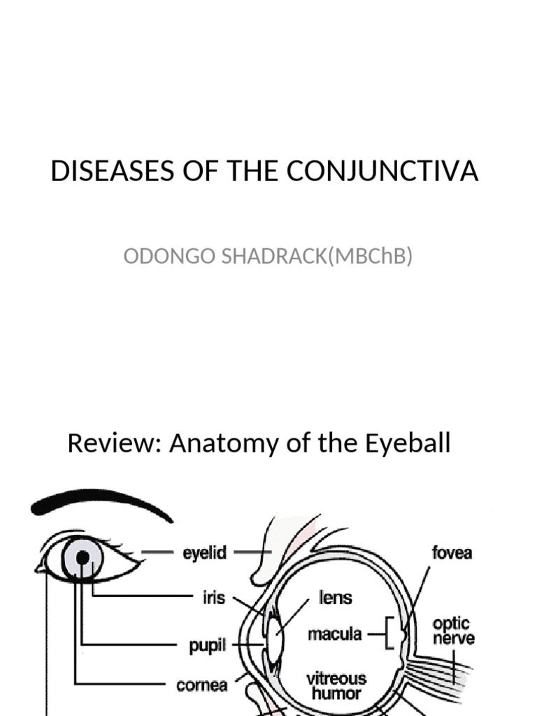 Conjunctivitis | PDF | Microbiology | Medical Specialties