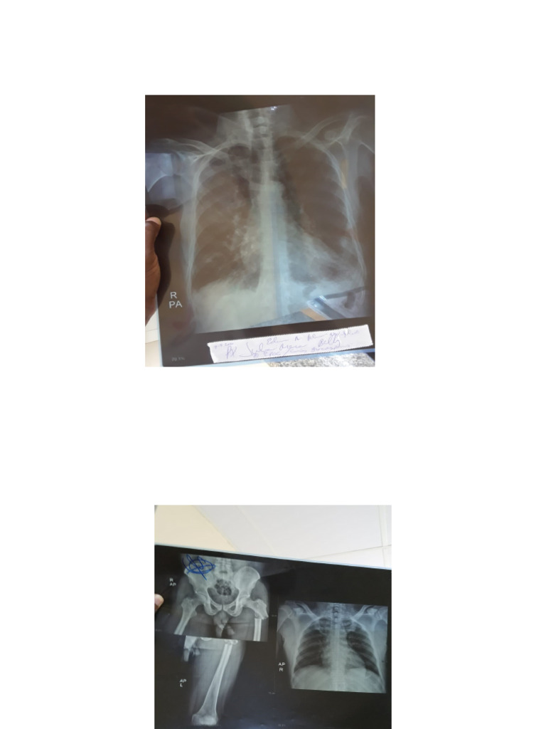 Rx. Imagen | PDF