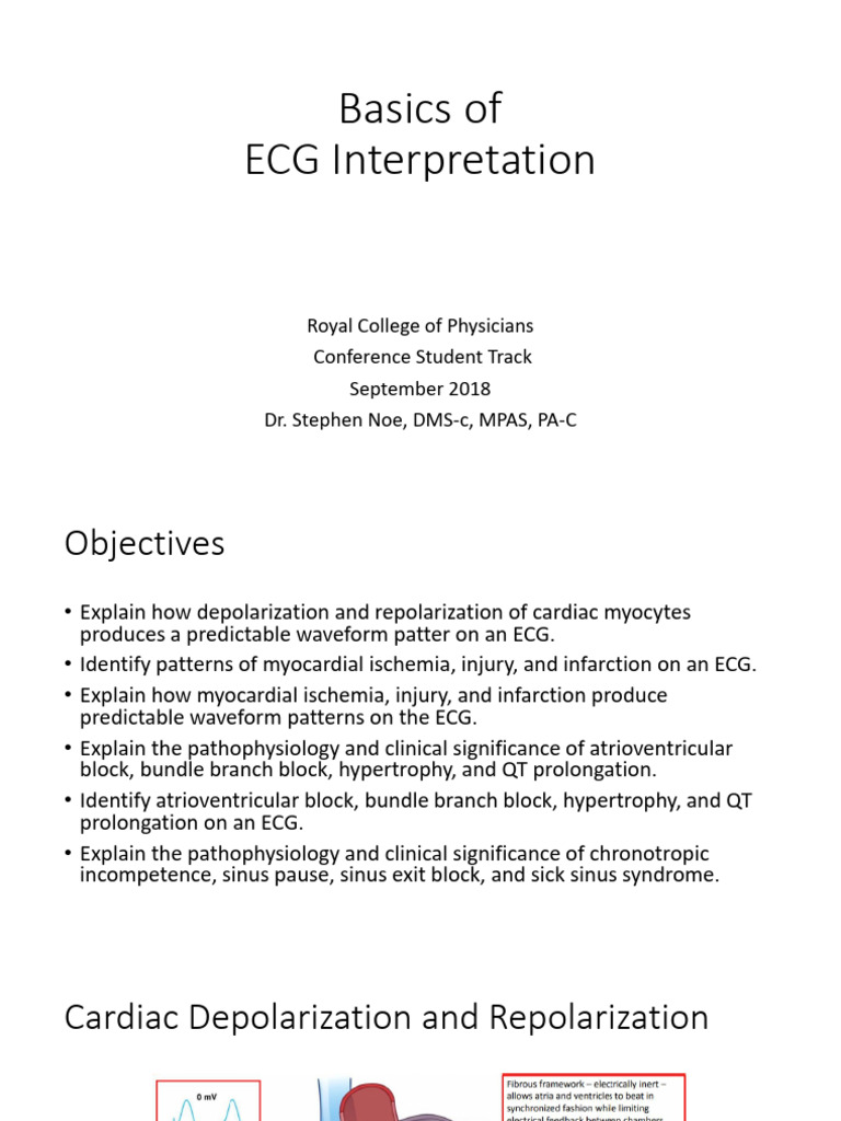 ECG Interpretation - Professor Steve Noe | PDF | Electrocardiography ...