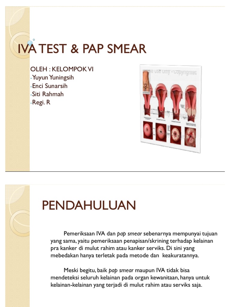 Iva Test & Pap Smear