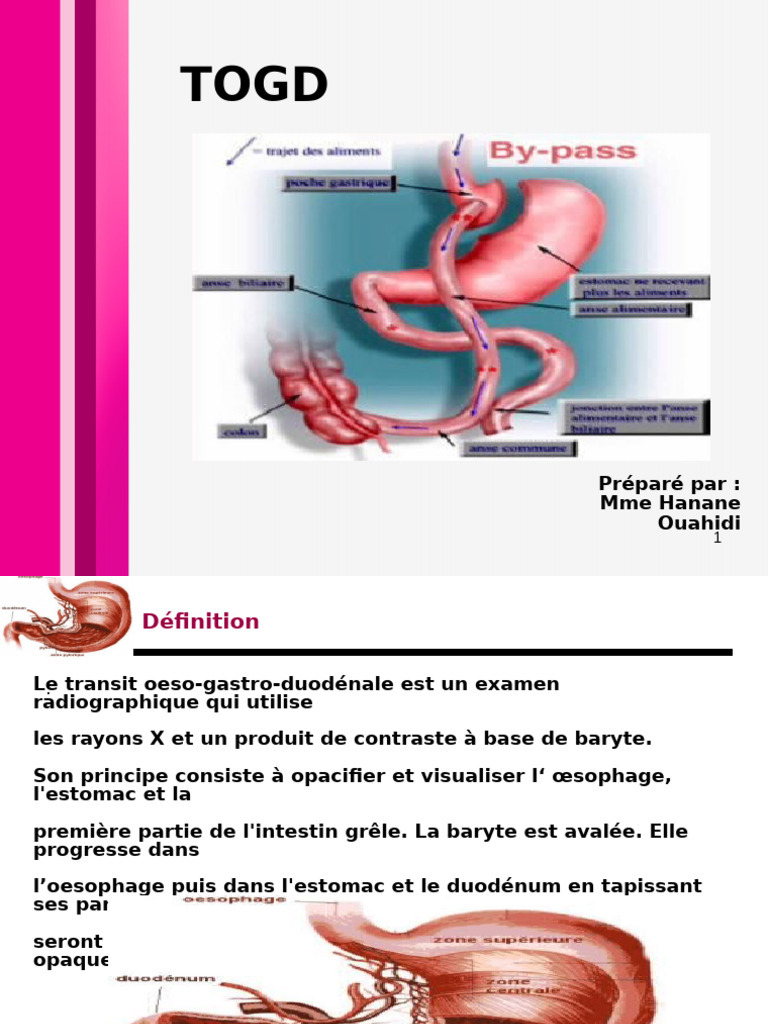 26 Togd | PDF | Estomac | Œsophage