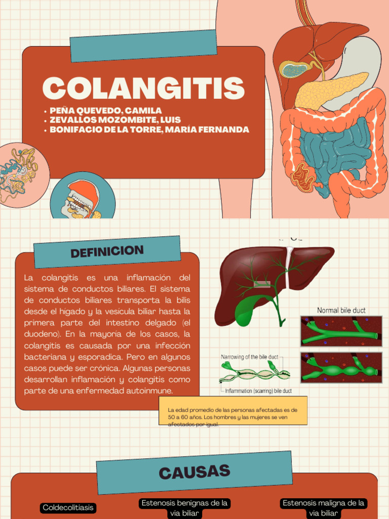 Colangitis: Causas e Imágenes Clínicas | PDF | Ciencia y matemáticas