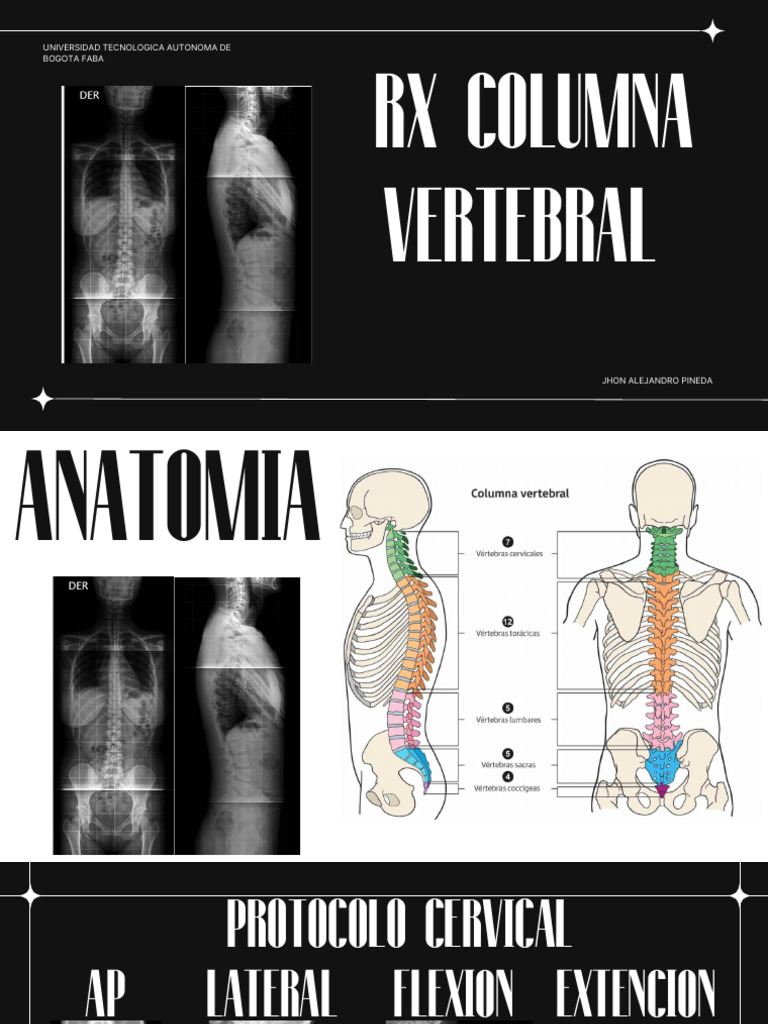 RX Columna vertebral | PDF | La columna vertebral | Sistema esquelético