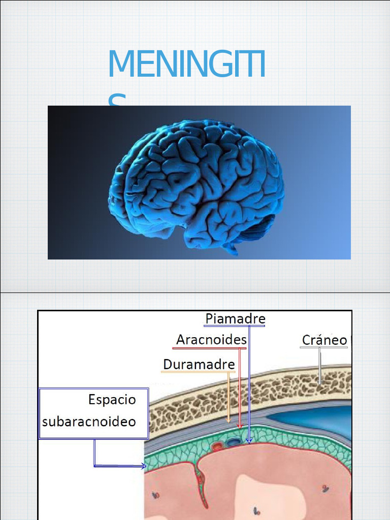 Meningitis: Tipos y Pronóstico | PDF | Meningitis | Especialidades Medicas
