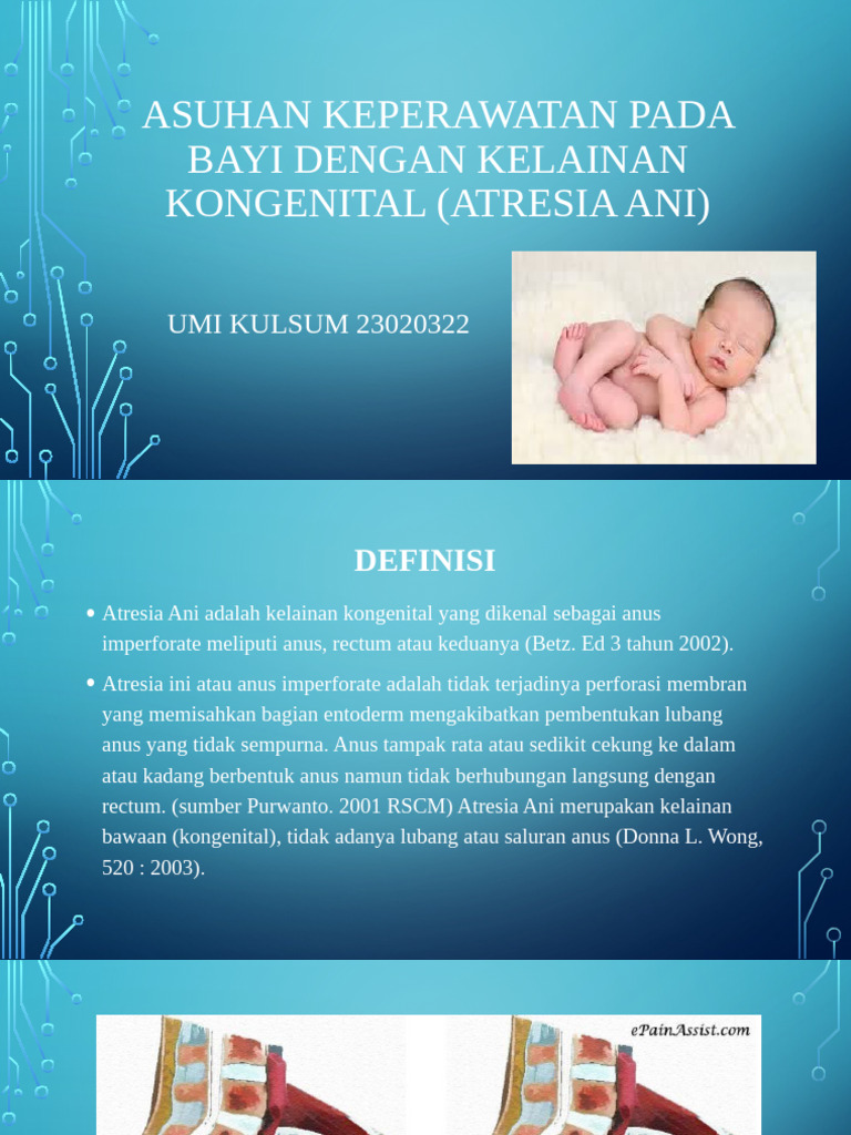 Keperawatan Anak Atresia Ani Umi Kulsum | PDF