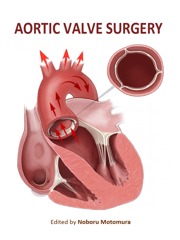 Aortic Valve Surgery (2011) | PDF | Coronary Circulation | Heart Valve