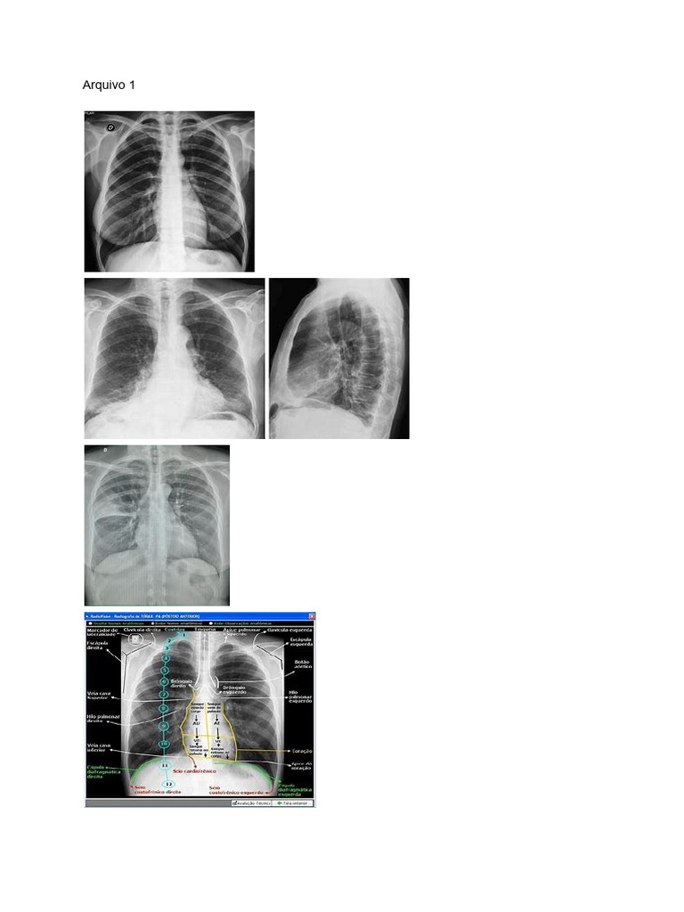 Arquivo Imagens de RX2 | PDF