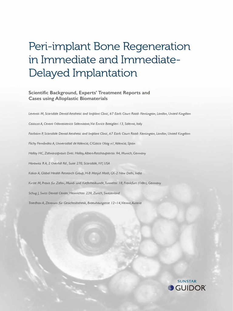 Peri Implant | PDF | Dental Implant | Medical Specialties