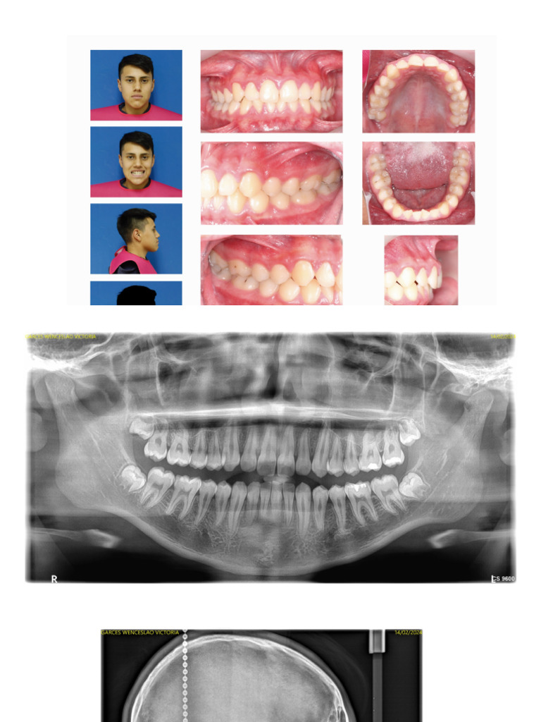 Wenceslao Victoria Garces | PDF