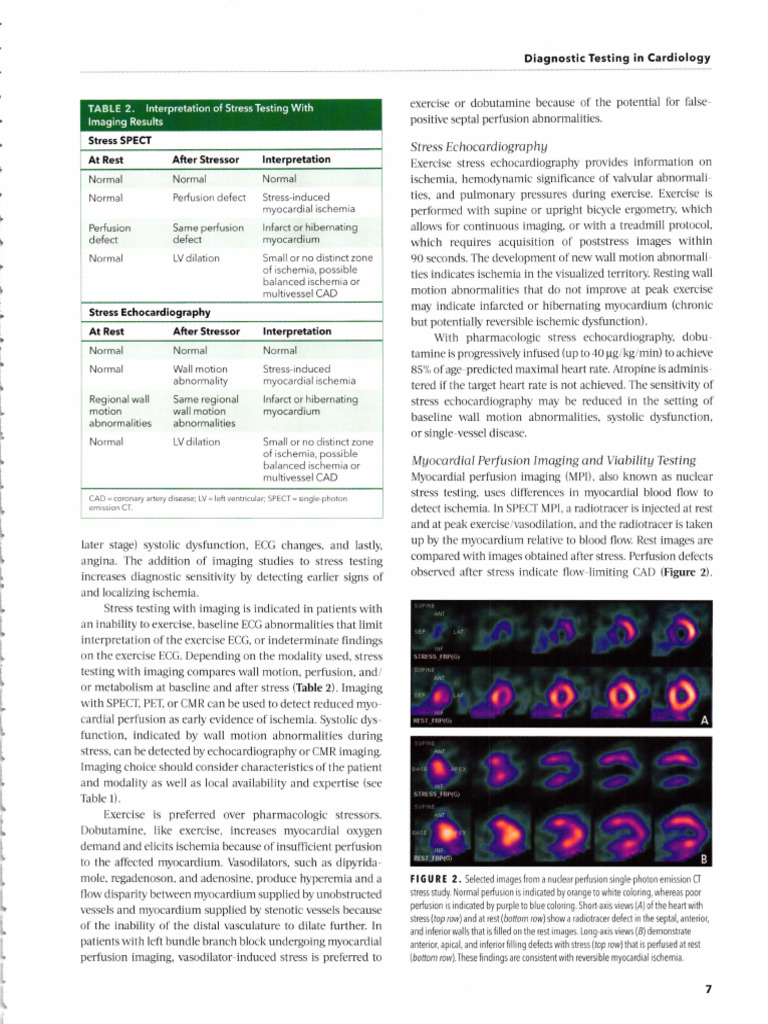 Mksap 19 Cardio - Parte2 | PDF | Echocardiography | Myocardial Infarction
