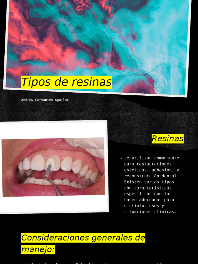 Tipos de Resinas Dentales y Usos | PDF | Diente | Compuesto Dental