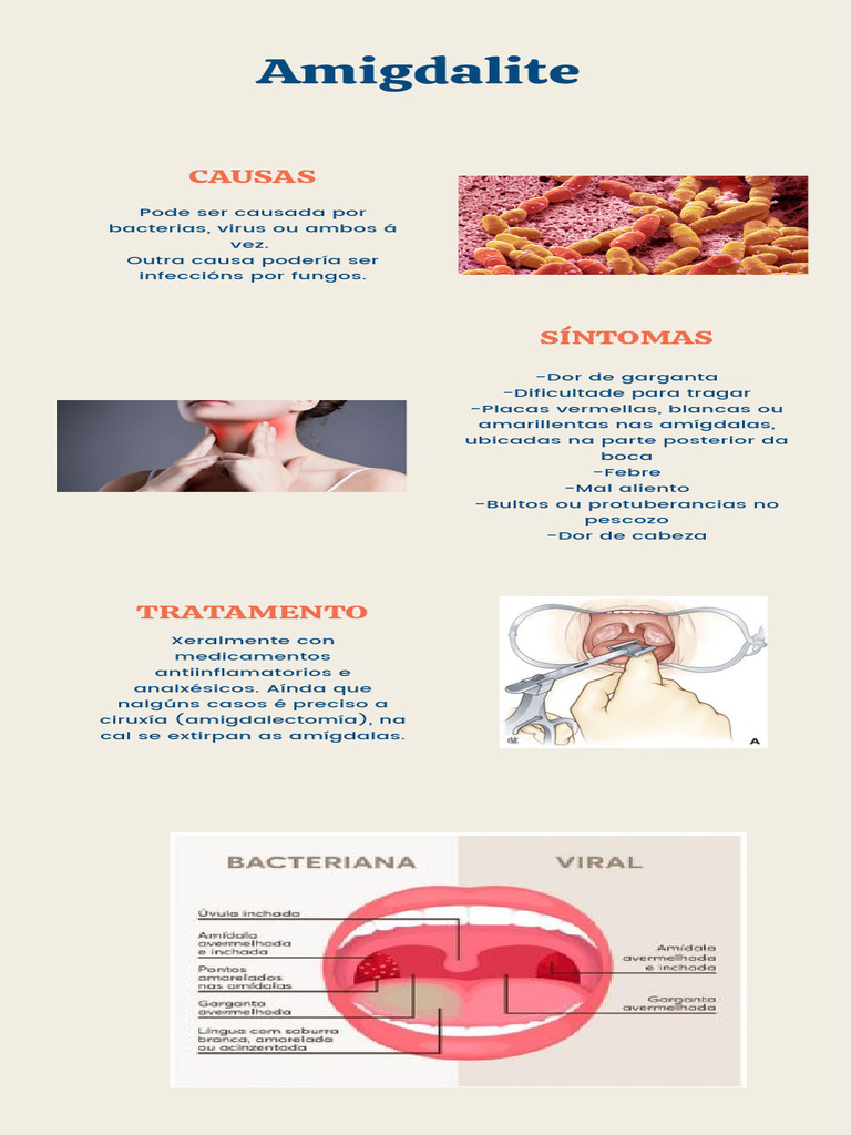 Infografía Amigdalite | PDF