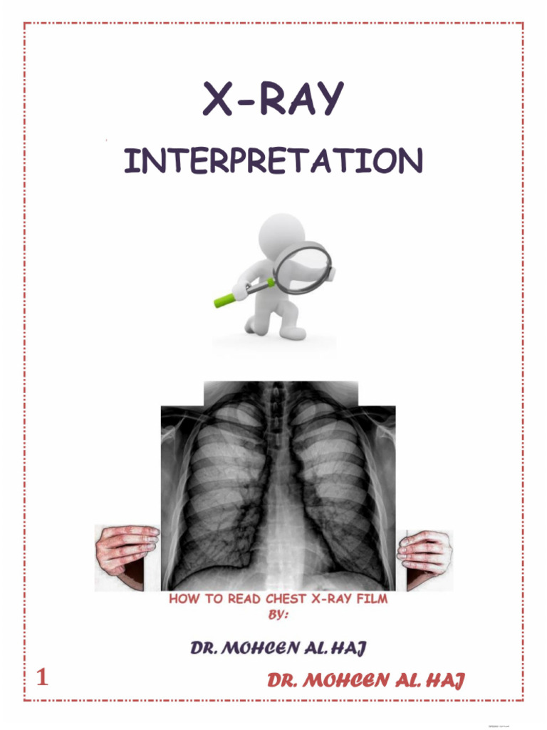 X Ray Interpretation | PDF