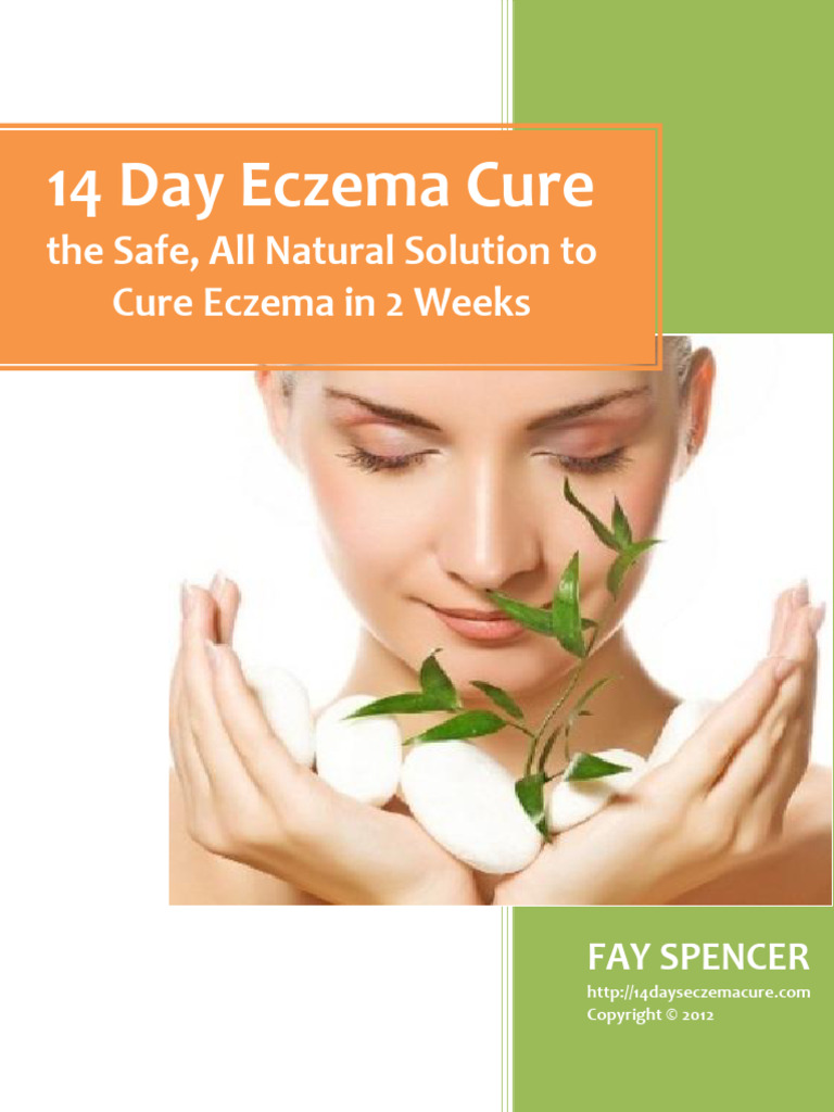 14 Day Eczema Cure (PDFDrive) | PDF | Dermatitis | Topical Medication