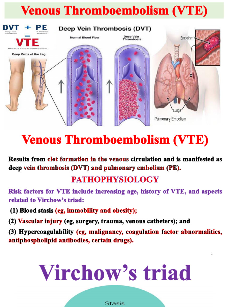 Venous Thromboembolism (VTE) | PDF | Thrombosis | Clinical Medicine
