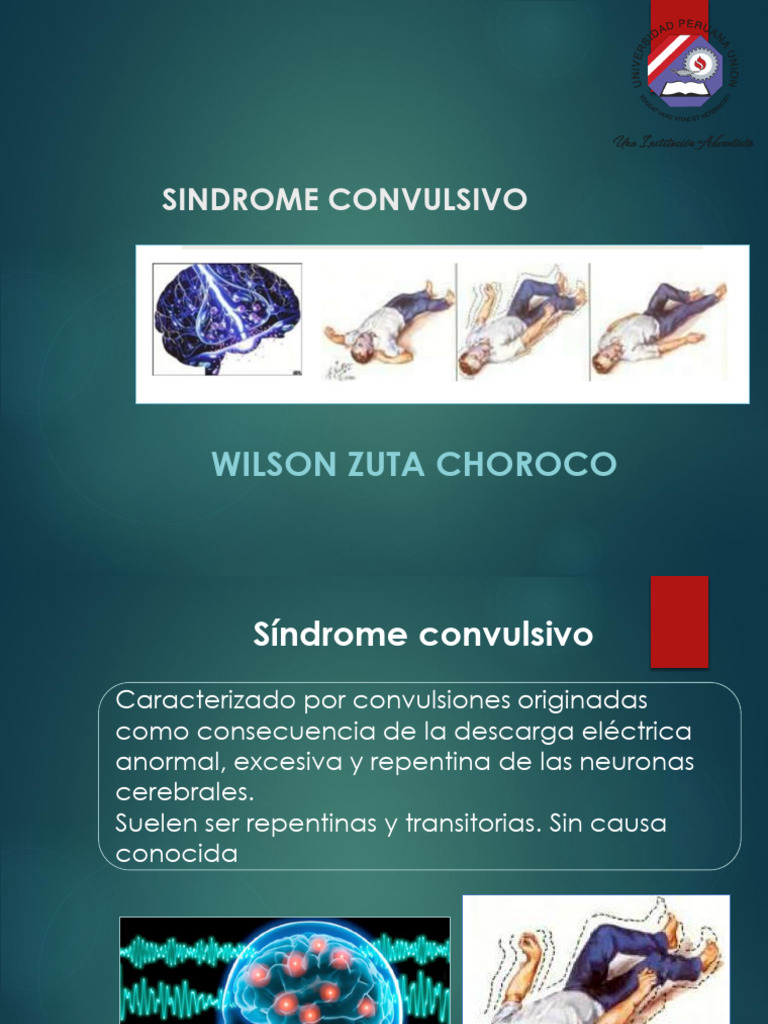 Síndrome convulsivo | PDF | Cerebro | Epilepsia