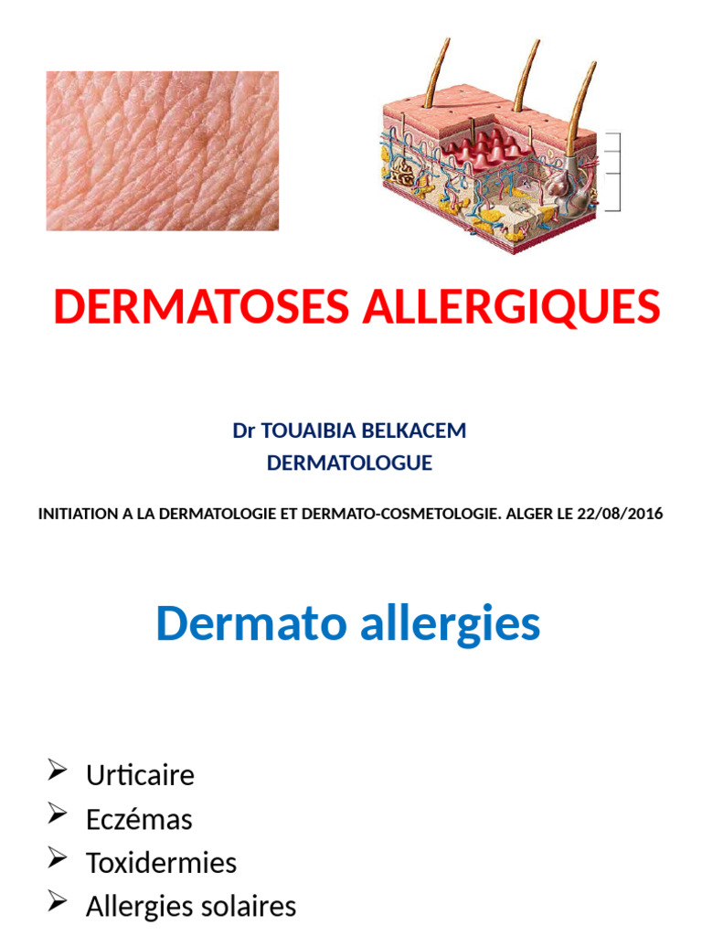 Dermatose Allergique : Urticaires et Eczémas | PDF | Dermatite | Allergie