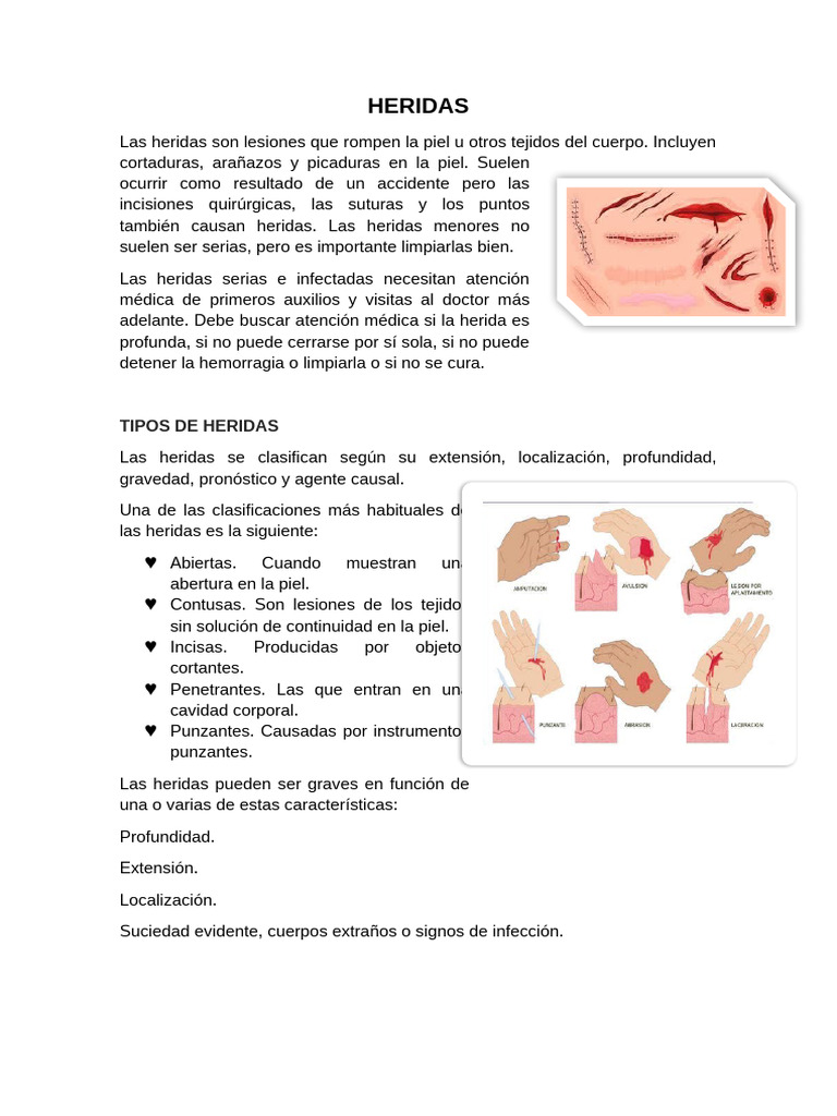 HERIDAS | PDF | Herida | Quemar