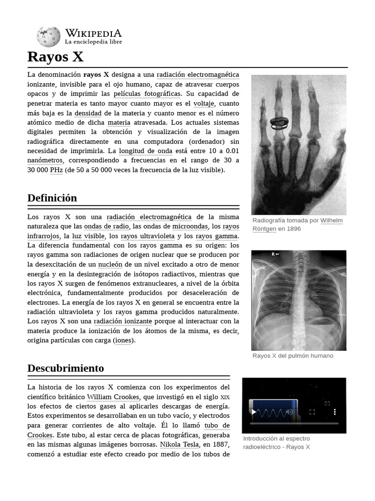 Historia y Producción de Rayos X | PDF | Rayo X | Electrón