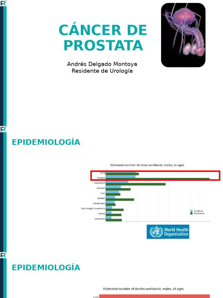 CA-DE-PROSTATA | PDF | Antígeno específico de la próstata | Cancer de prostata