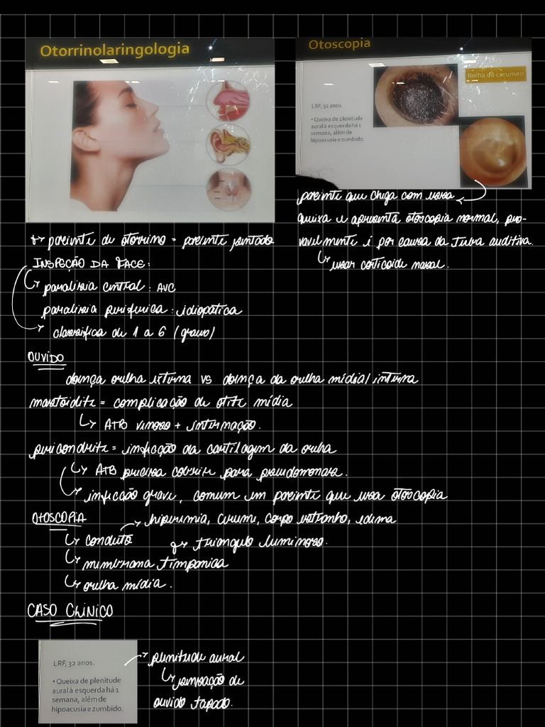 Aula Otorrino | PDF