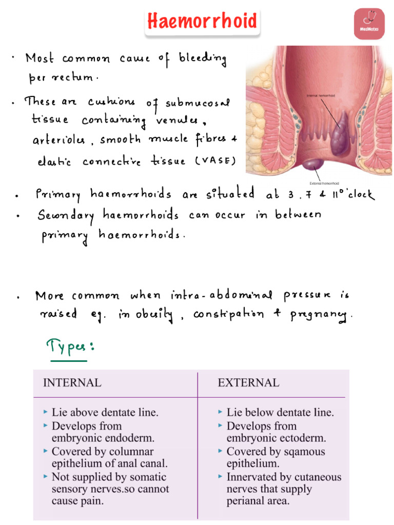 Haemorrhoids | PDF | Hemorrhoid | Gastroenterology