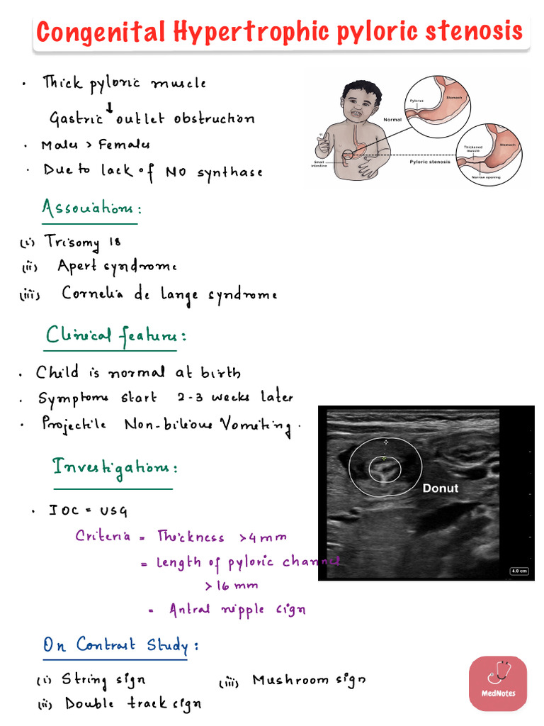 Pyloric Stenosis: Signs and Interventions | PDF | Digestive System ...