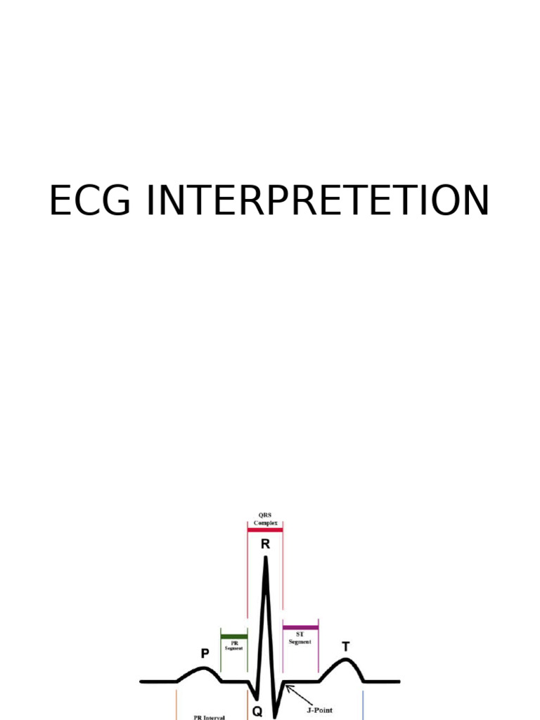 ECG, Presentation | PDF