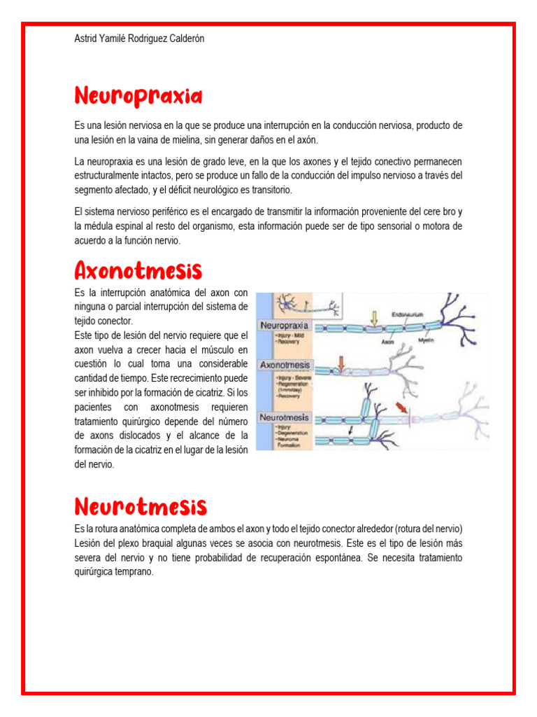 Neuropraxia, Axonotmesis y Neurotmesis | PDF