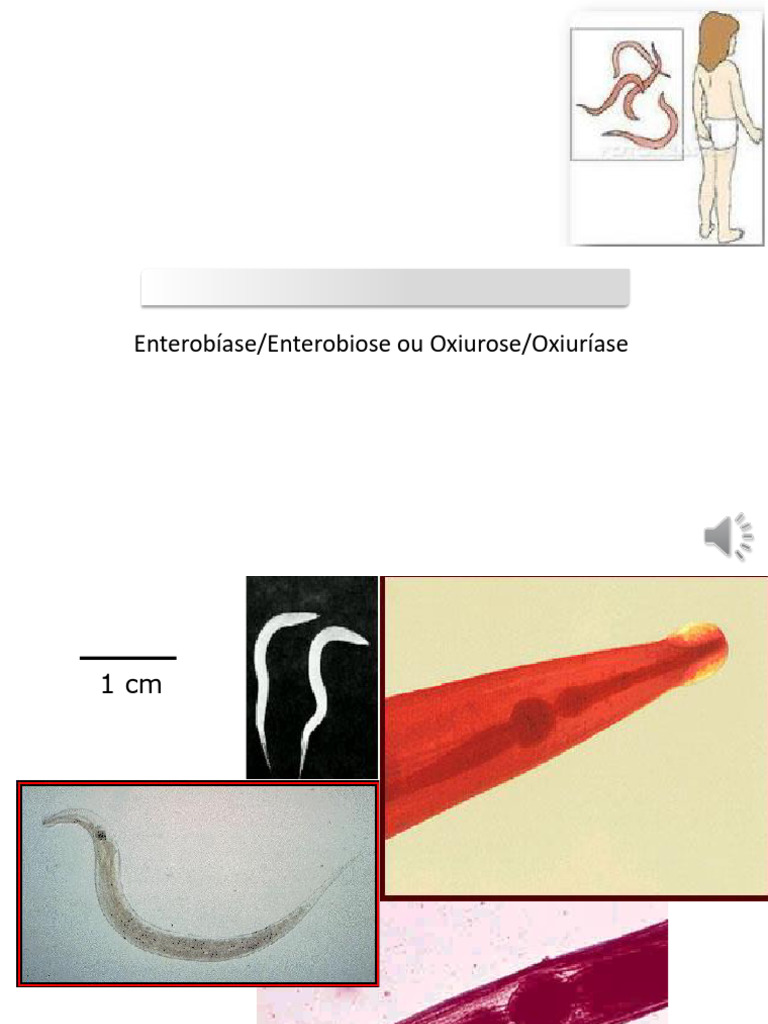 Aula 13 - Trichuris e Enterobius | PDF | Especialidades médicas ...