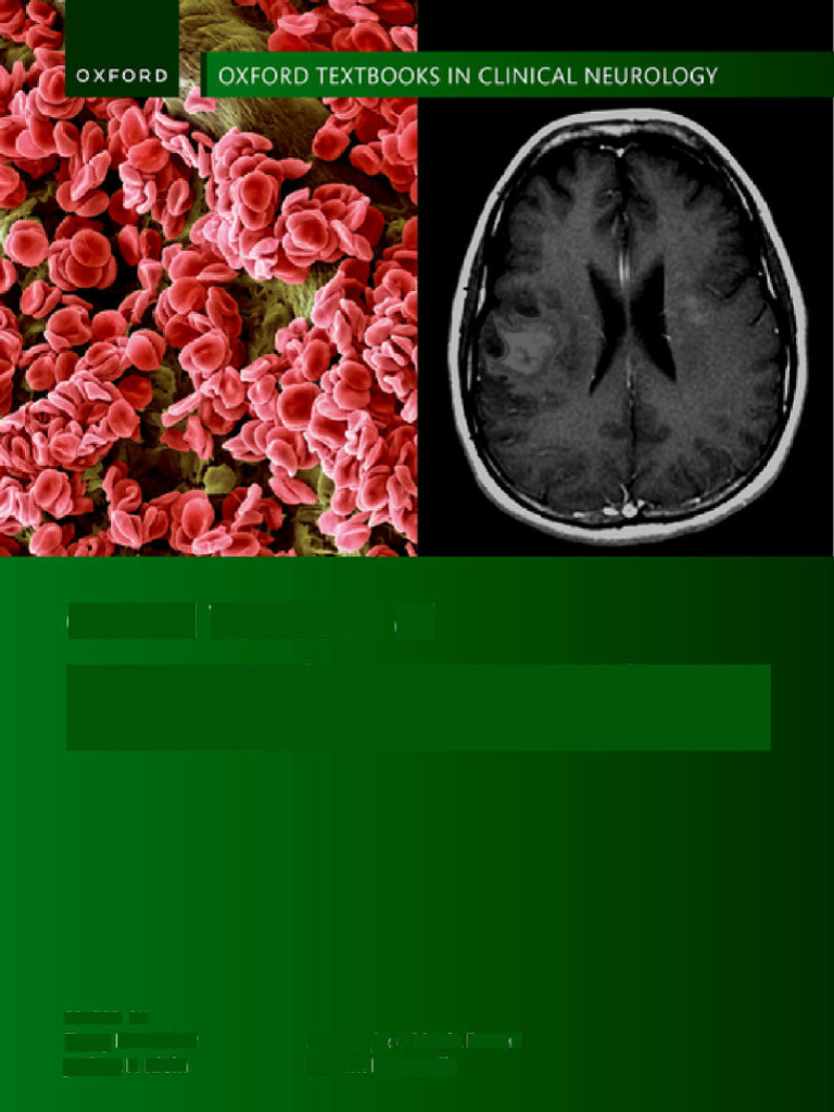 Oxford Textbook of Neurohaematology (Oxford Textbooks in Clinical ...