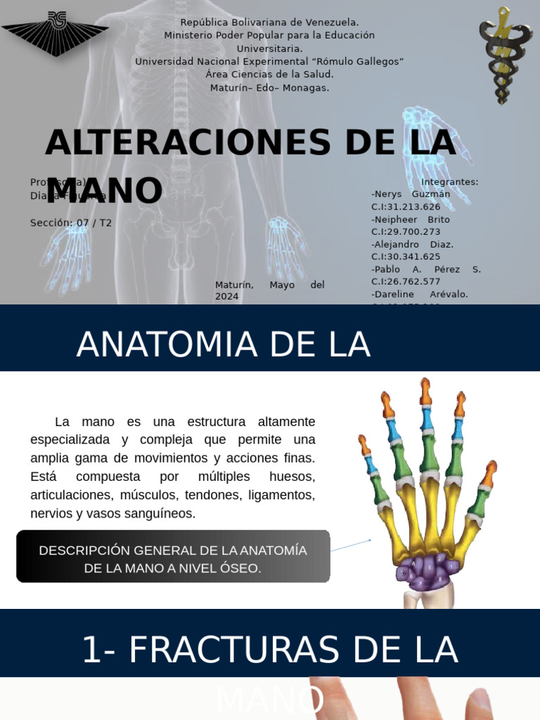 Alteraciones de La Mano PPT Final | PDF | Mano | Nervio