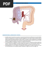 Sigmoidectomia Laparoscopica | PDF | Intestino grueso | Cirugía