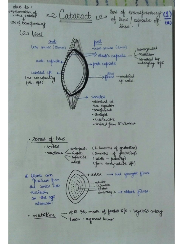 Cataract | PDF
