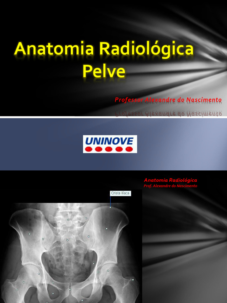 Anatomia Radiológica Pelve | PDF | Útero | Anatomia humana