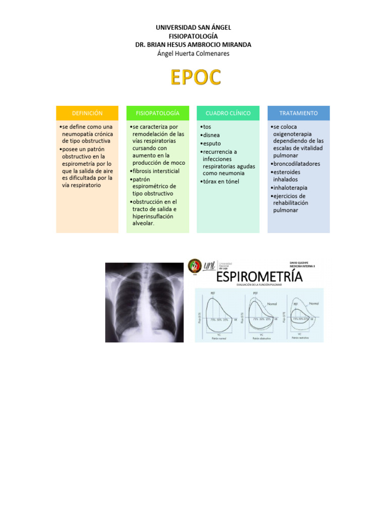 EPOC | PDF
