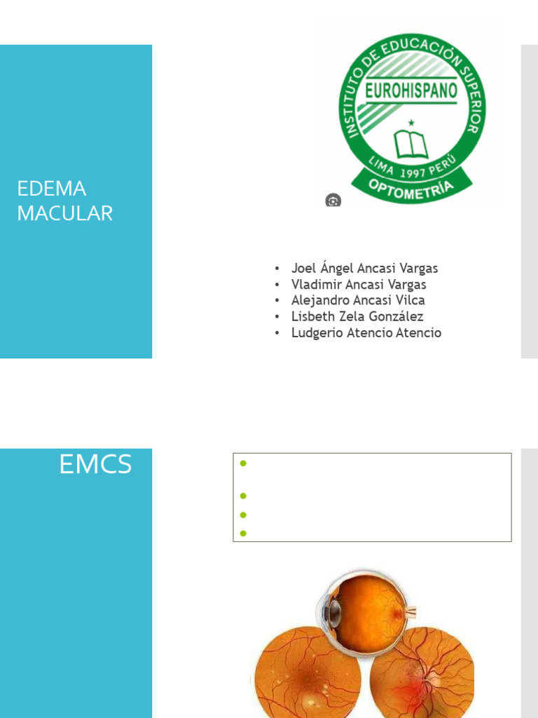 EDEMA MACULAR | PDF | Percepción visual | Diabetes