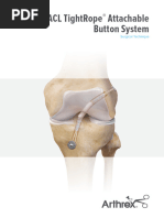 Arthrex AC Joint Repair Techniques | PDF | Surgical Suture | Joints