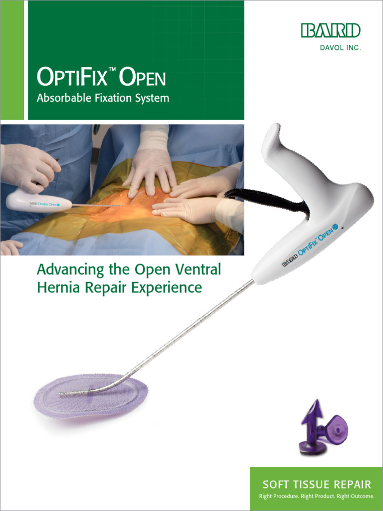 OptiFix-Open-Brochure1 (2) | PDF | Medical Specialties | Clinical Medicine