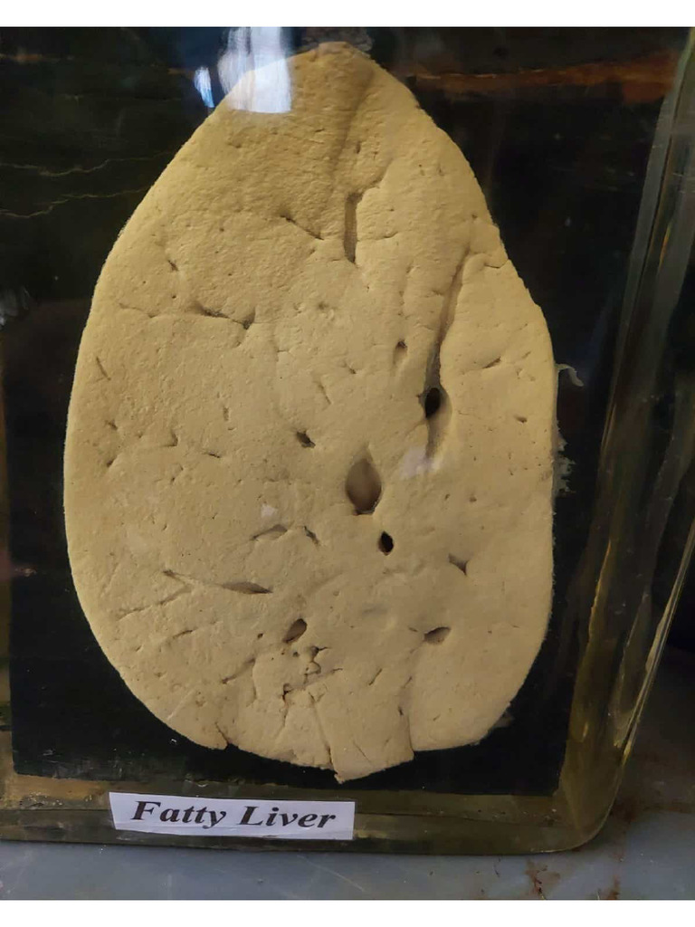 Patho Gross Specimens | PDF