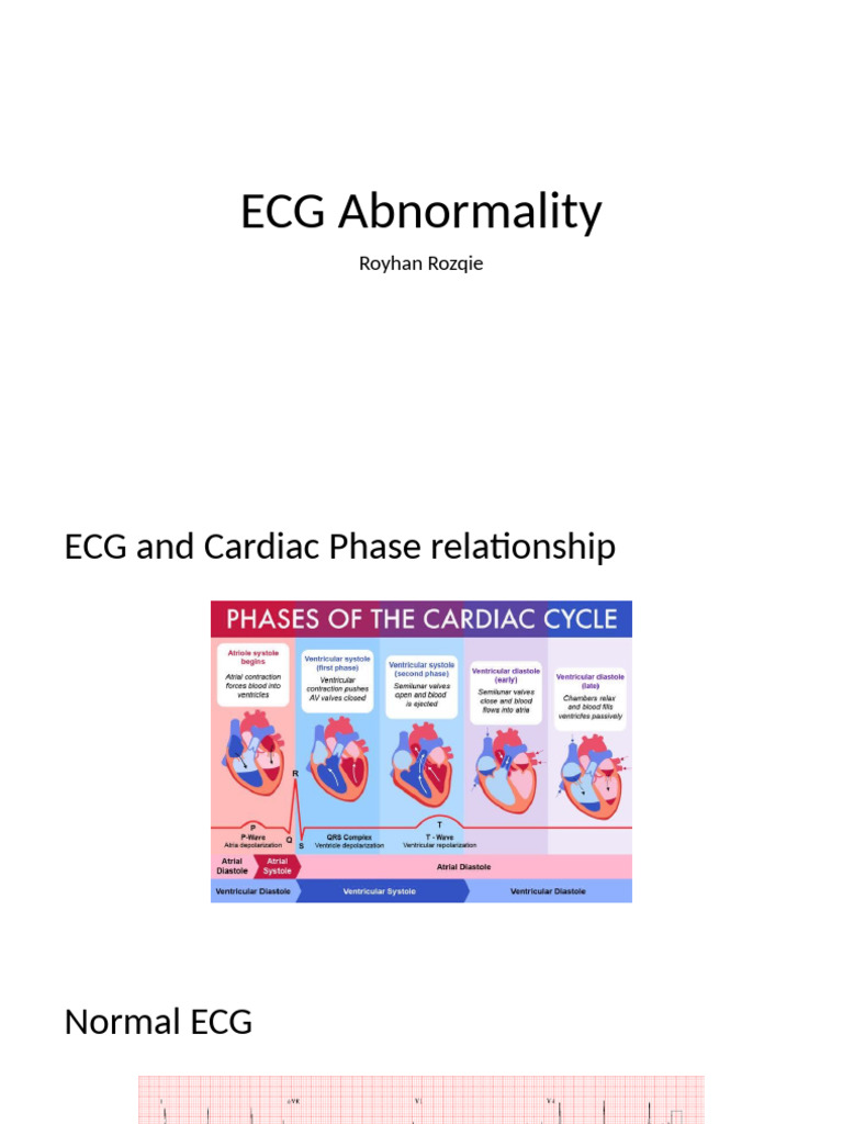 ECG Abnormalities and Evaluation Steps | PDF | Electrocardiography ...
