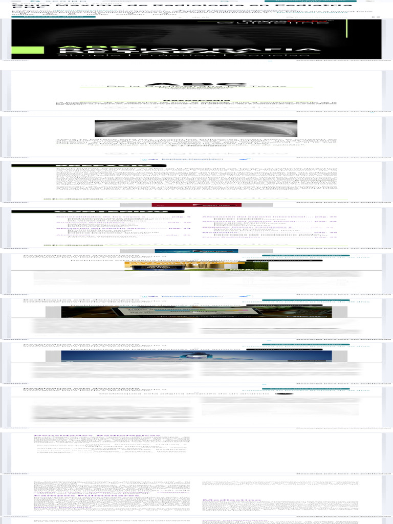 Guia Maxima de Radiologia en Pediatria PDF PDF Pulmón Rayo X 3 | PDF | Rayo X | Radiación