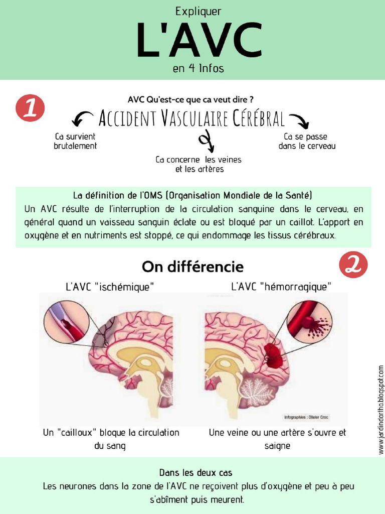Fiche Explicative - L - AVC | PDF