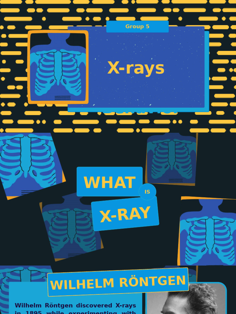 X Rays | PDF | X Ray | Ct Scan