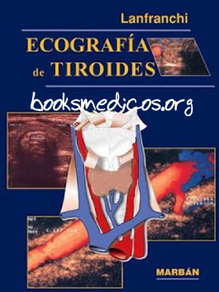 Ecografia de Tiroides | PDF