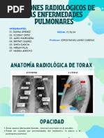 Patologías en RX | PDF | Pulmón | Tórax